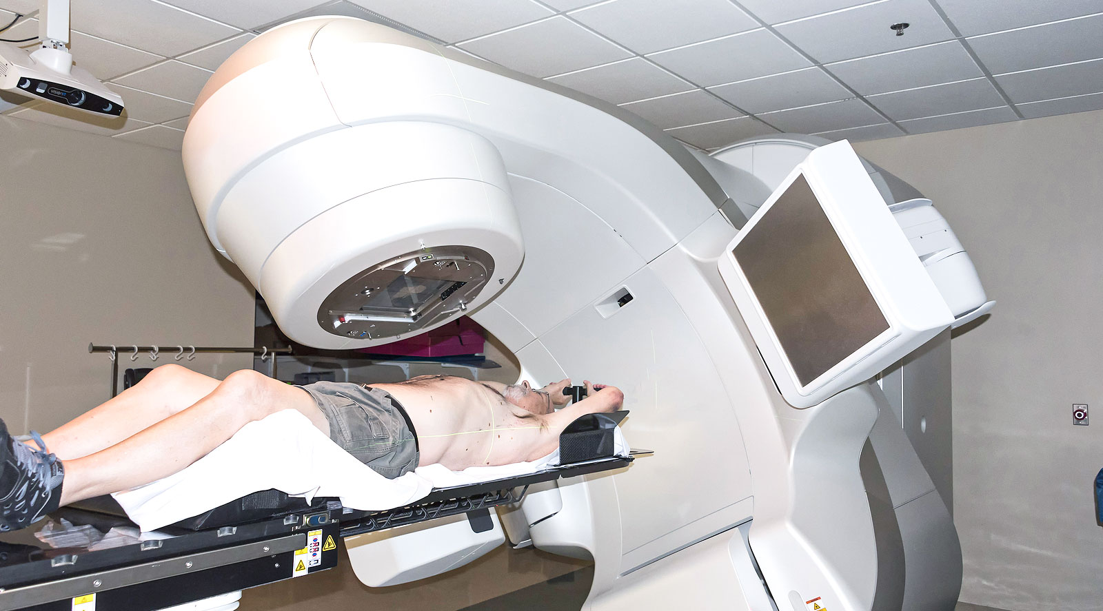 What Are The Negative Side Effects Of Having Radiotherapy?