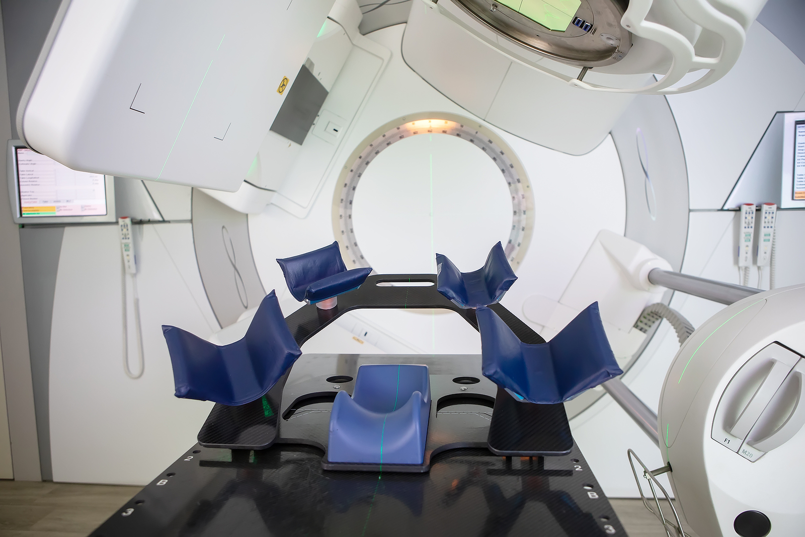 How Does TrueBeam Radiotherapy Work in Treating Cancer?