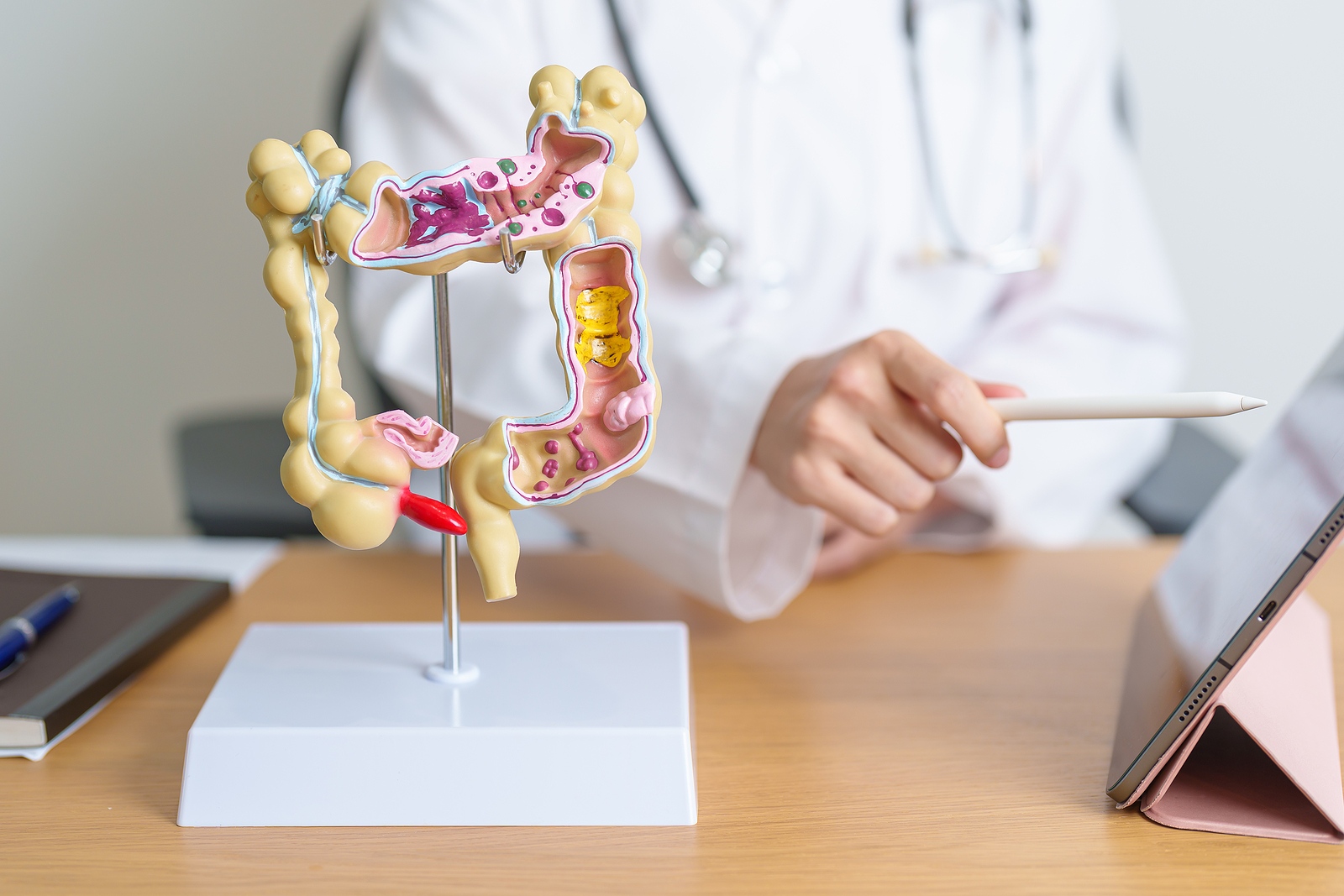How Is Radiotherapy Used To Treat Colorectal Cancer?
